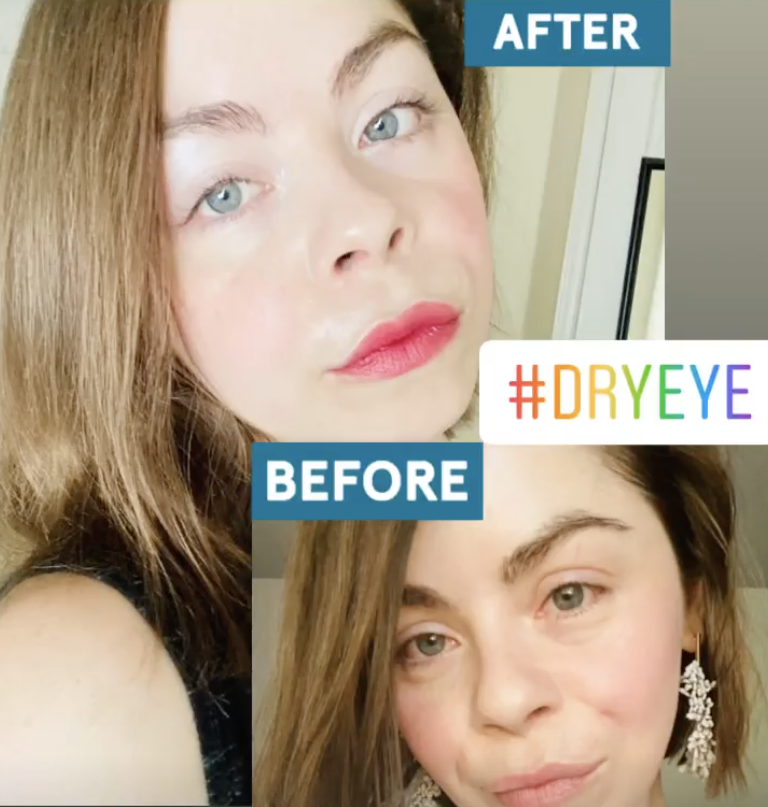 Dry Eye + Solutions - Eat Your Greens Out